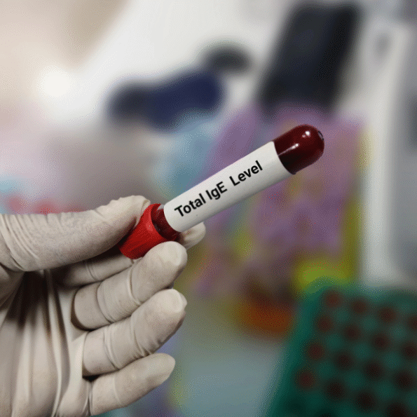 Specific IgE Allergy Panel (Individual Allergen Tests) – Healthfame